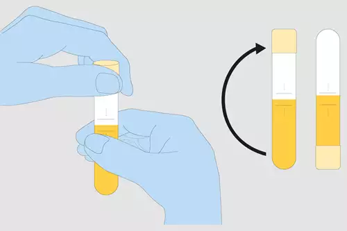 Självprovtagning klamydia och gonorré - instruktion VGR - 1177